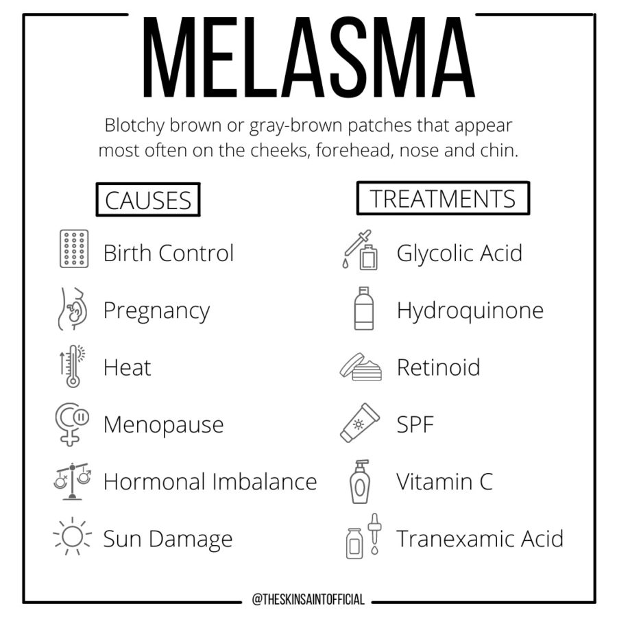 All About Melasma | The Skin Saint Blogs Birmingham | Face Beauty Science