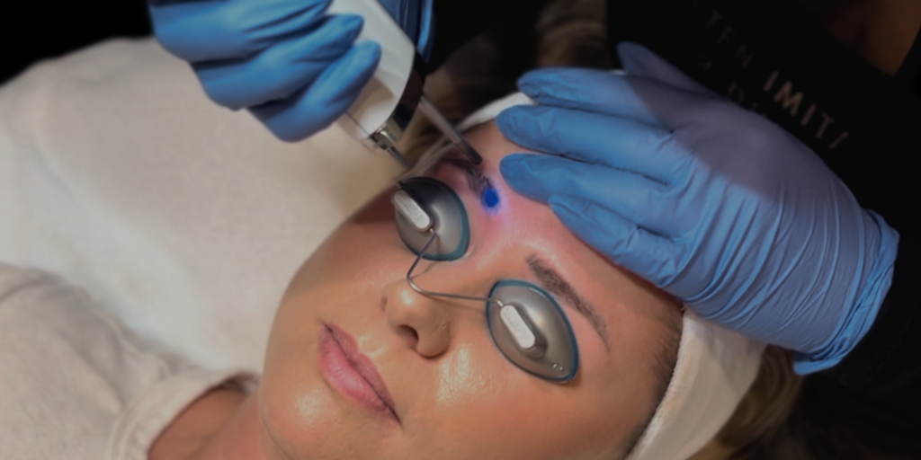 Microblading Tattoo Removal | Face Beauty Science